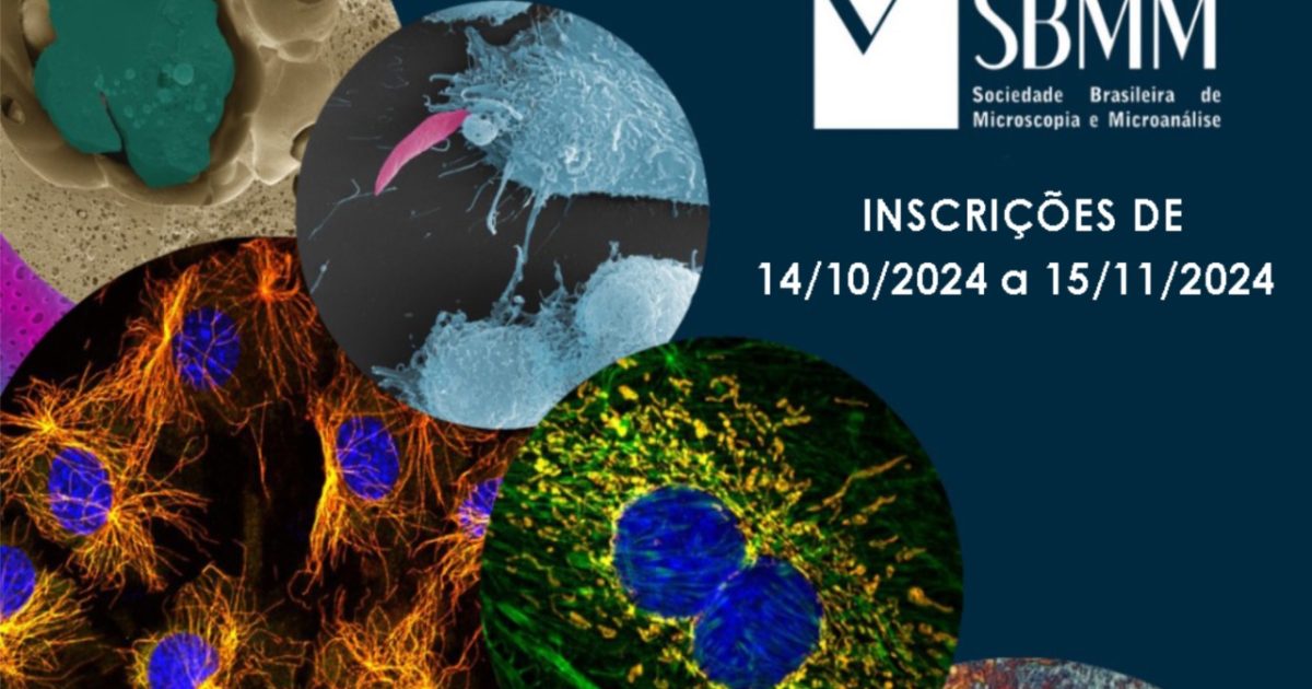 II Concurso de Imagem da SBMM | SBMM