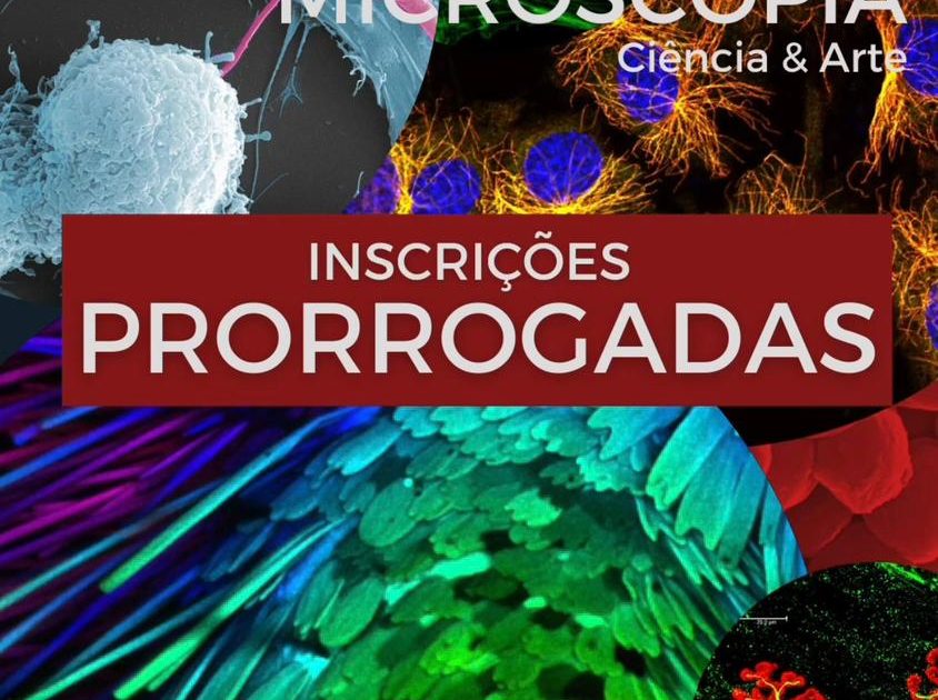 II Concurso de Imagem da SBMM | SBMM